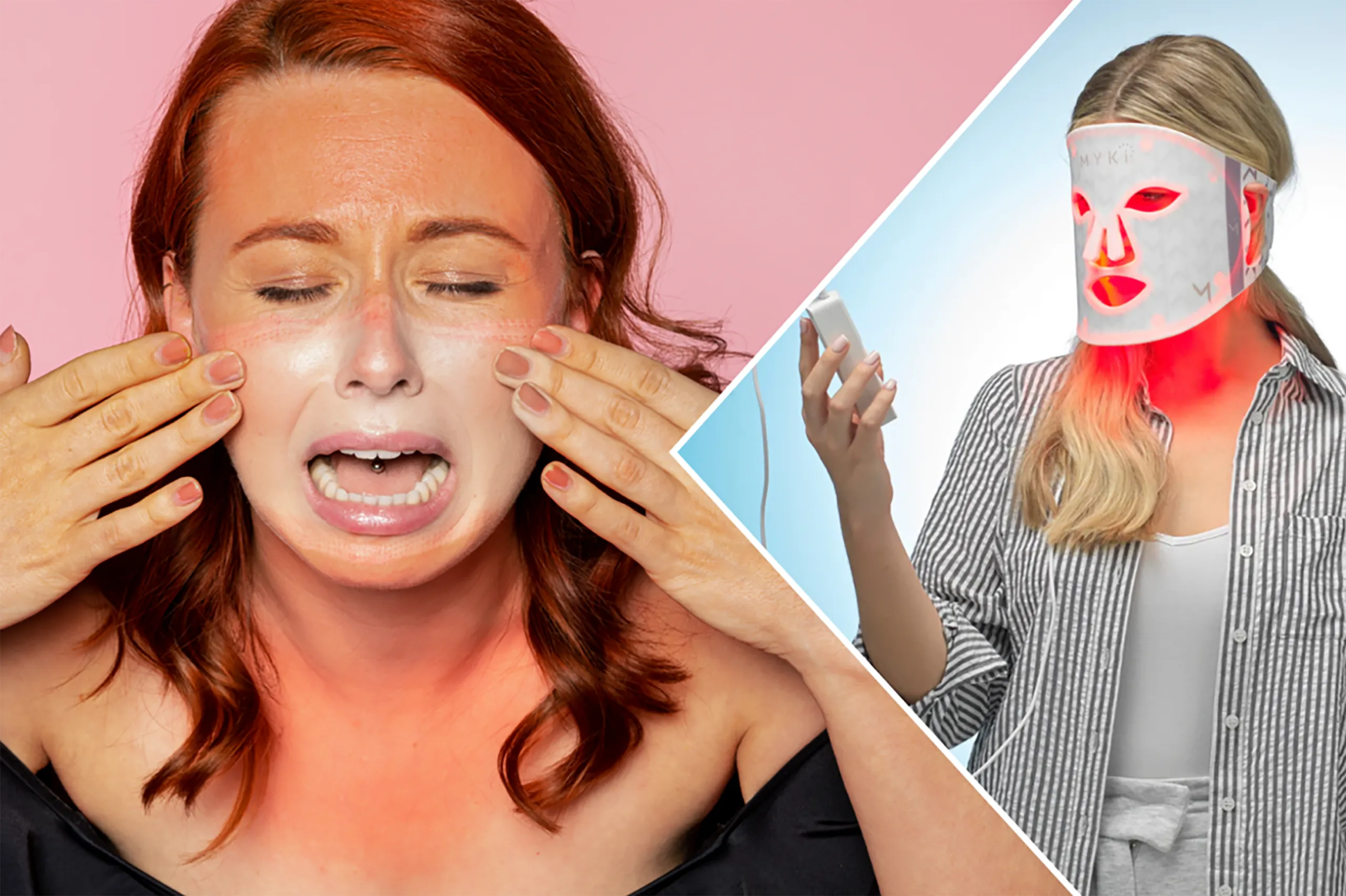 Sun-Damaged Skin Recovery with LED Masks | MyKi Beauty